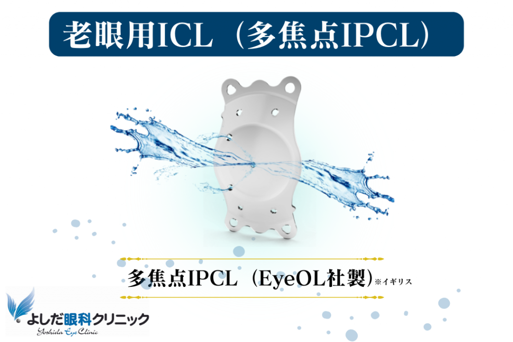 ICLによる老眼治療-多焦点IPCL｜大阪市港区 よしだ眼科クリニック